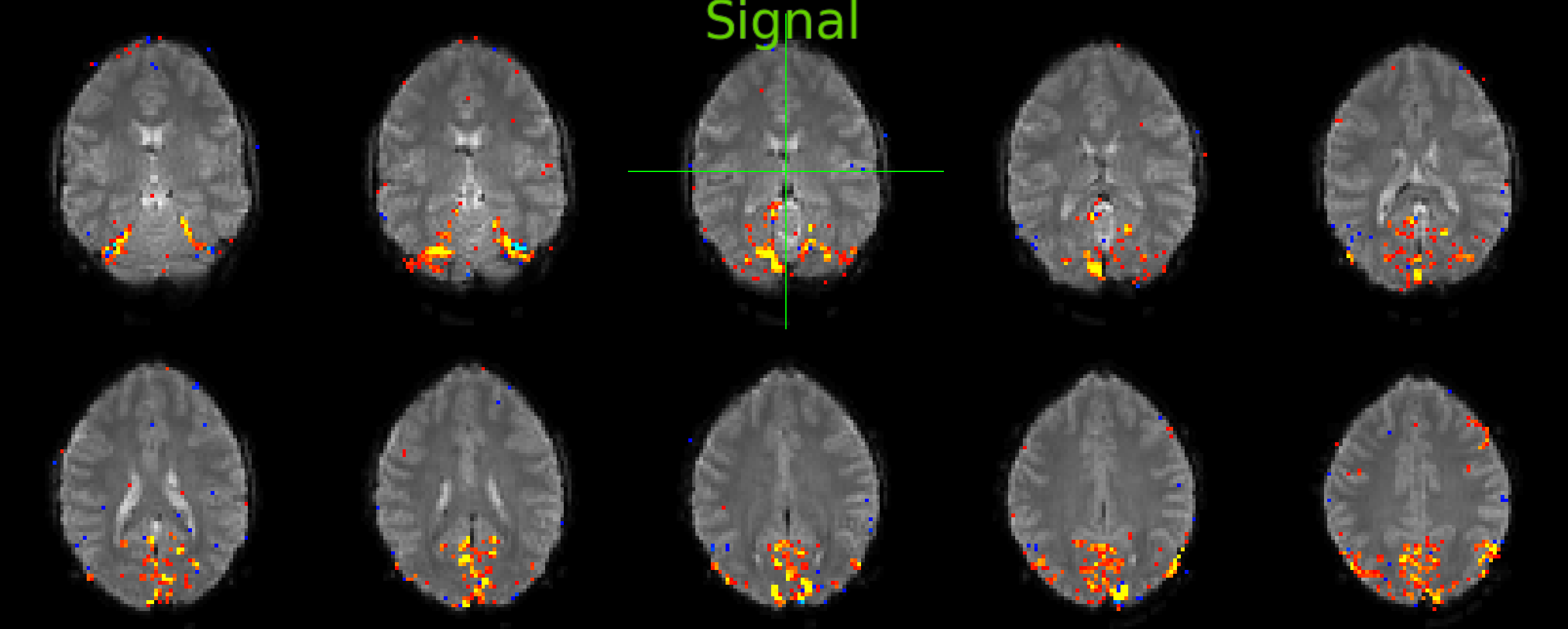 How to classify ICA components | Caroline Nettekoven